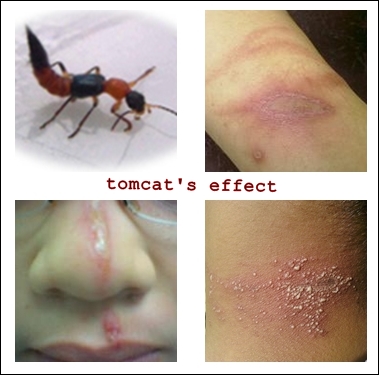 Cara Mengatasi dan Mencegah Gigitan Tomcat | KASKUS